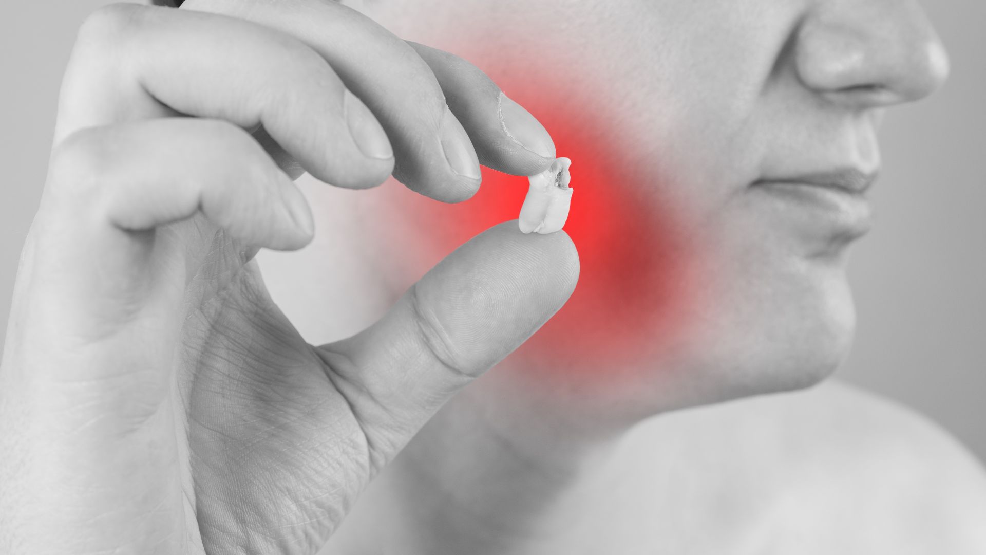 Wisdom Tooth Coming In-11 Signs & Symptoms - Power Tooth Paste